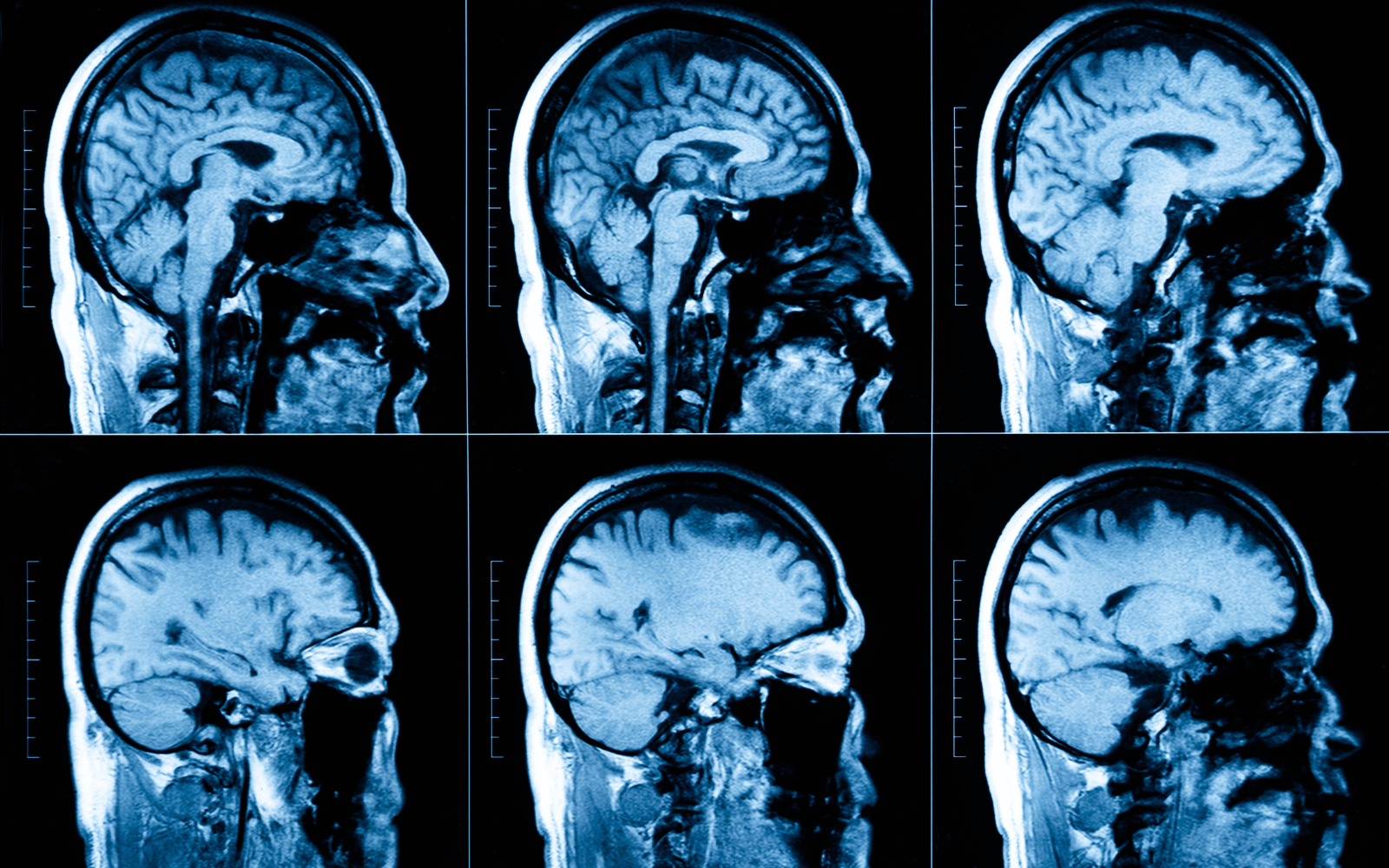 Why Choose Us? - MaxResolutionImaging